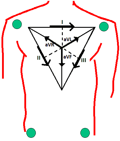1.4: Maquinaria y configuración de ECG - LibreTexts Español