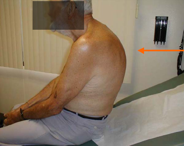 23.2: Physical Assessment of the Thorax - Medicine LibreTexts