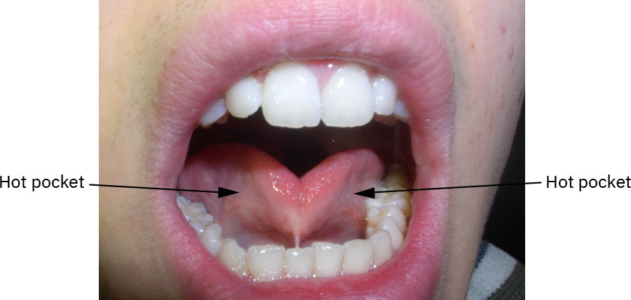 7.2: How to Perform Vital Signs - Medicine LibreTexts