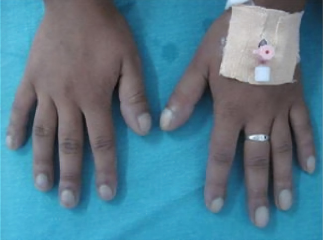 11.2: Upper and Lower Respiratory Assessment - Medicine LibreTexts