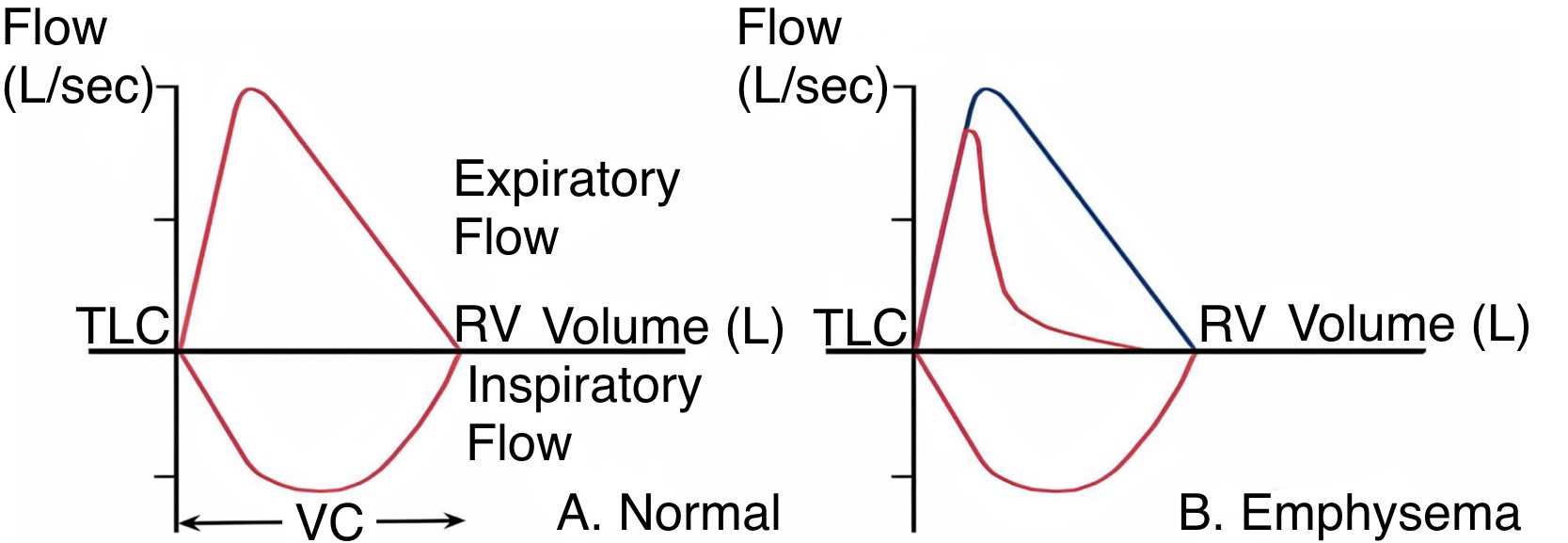 12.4: Mechanics of Breathing - Medicine LibreTexts